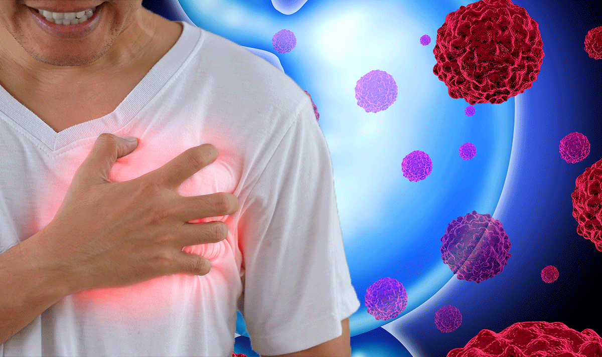 First Signs Of Stomach Cancer Nhs - CancerWalls